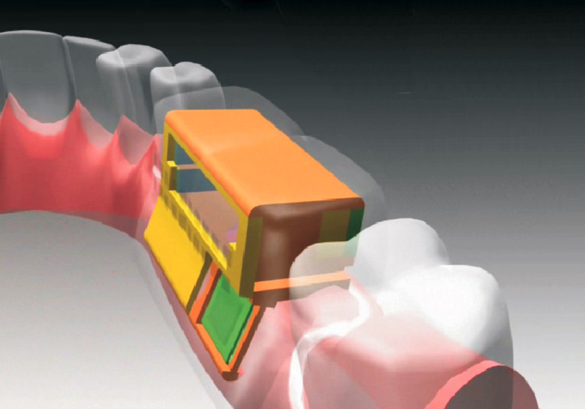 HSG-IMIT – Institut für Mikro- und Informationstechnik der Hahn ...